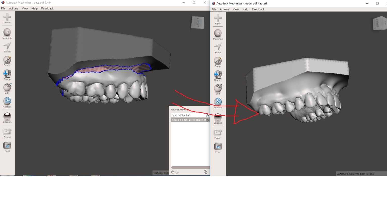 How to create 3D models in Digital Dentistry with Meshmixer software - Digital Dentistry Academy