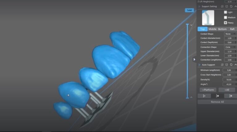 Meshmixer Master Pack®: Transform your Practice in Digital Dentistry ...